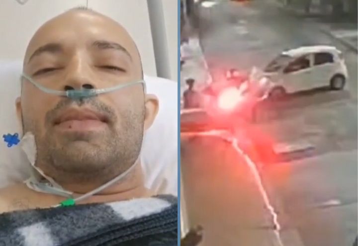 SP: PM tem perna amputada após ser atropelado em serviço - SBT News